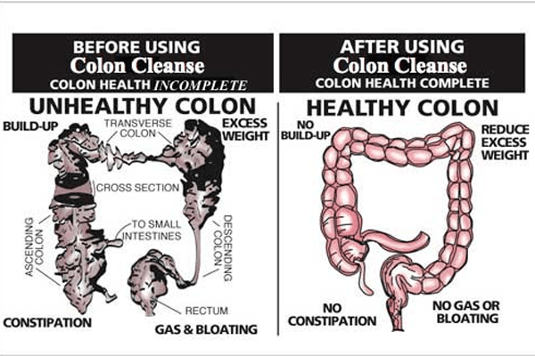 Kolonics Benefits: Colon Hydrotherapy Weight Loss and Intestinal Cleanse