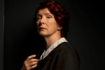 Why Frances Conroy have discolored eyes? A Car Crash Accident